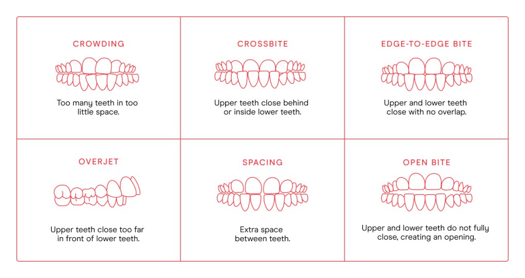 Dental Braces, Teeth Braces, Dental Clear Aligners in Waldorf MD